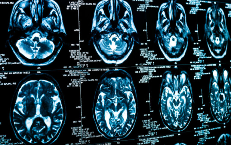 Use of MRI in Detecting Infectious and Inflammatory Diseases - ILFC